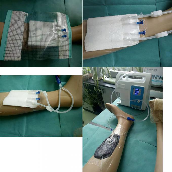 Sterilized Non Woven Wound Dressing Set Adhesive Disposable For Hospital